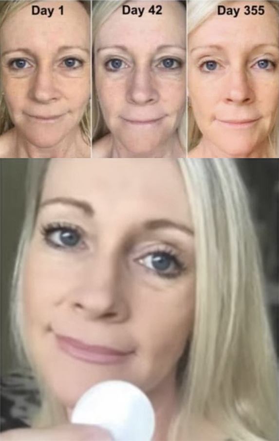 Ascent – X39 Stem Cell Activation Patches – Regenerate and Repair. The LifeWave X39 patches ...